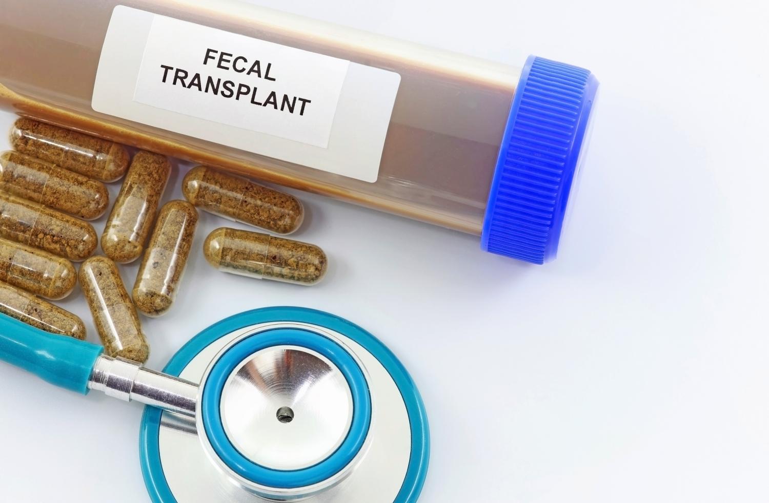 New Guidelines Recommend Fecal Microbiota Transplant Related Therapies For Most Patients With